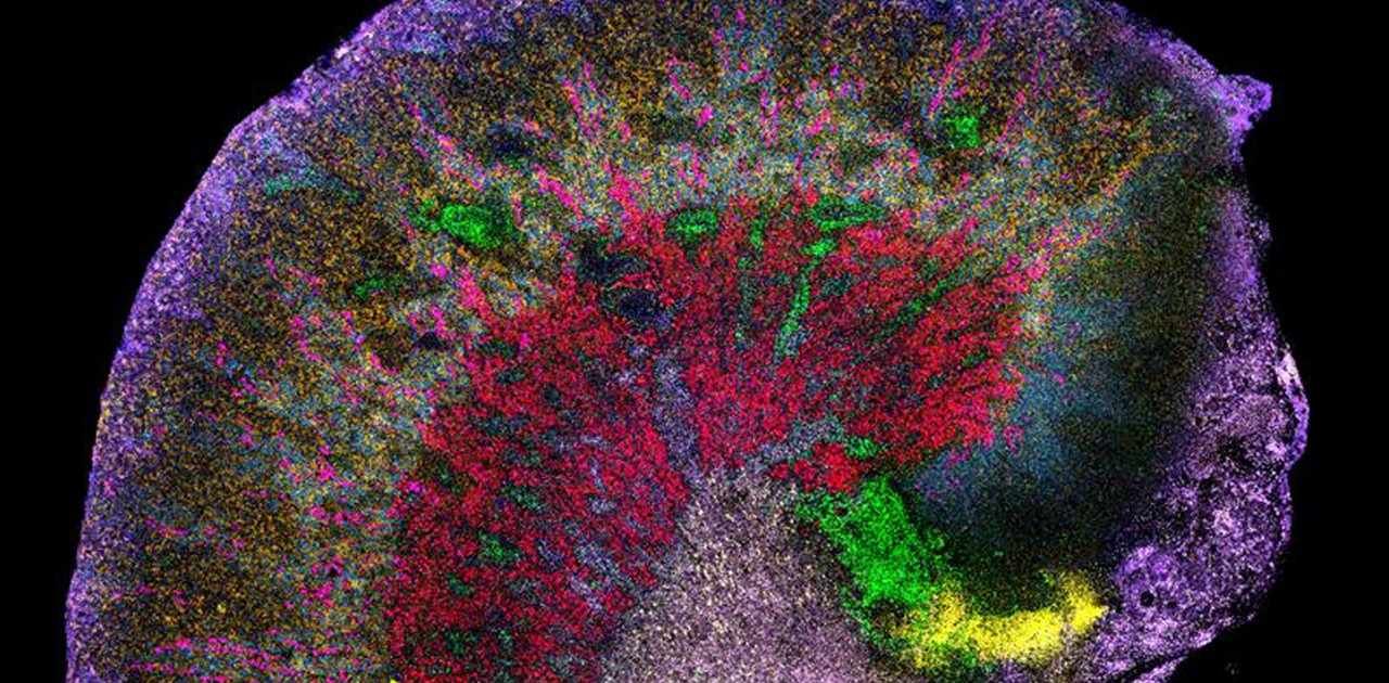 Confidence in spatial identifications using iprm-PASEF on the timsTOF ...