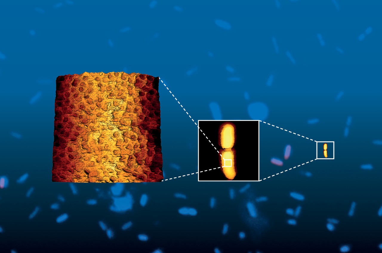 JPK NanoWizard ULTRA Speed 3 | Bruker