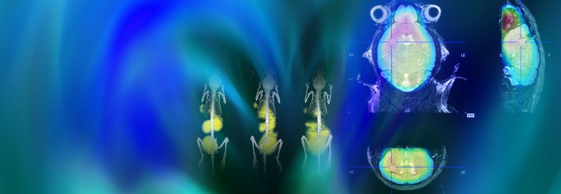 CEST Evolution and Applications | Bruker