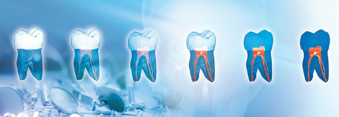 Dental | Bruker
