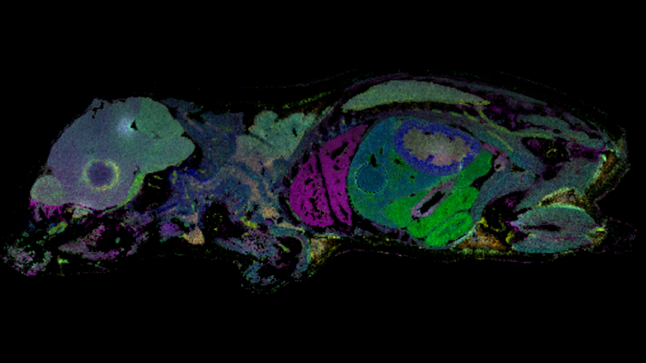 MALDI Imaging | Bruker