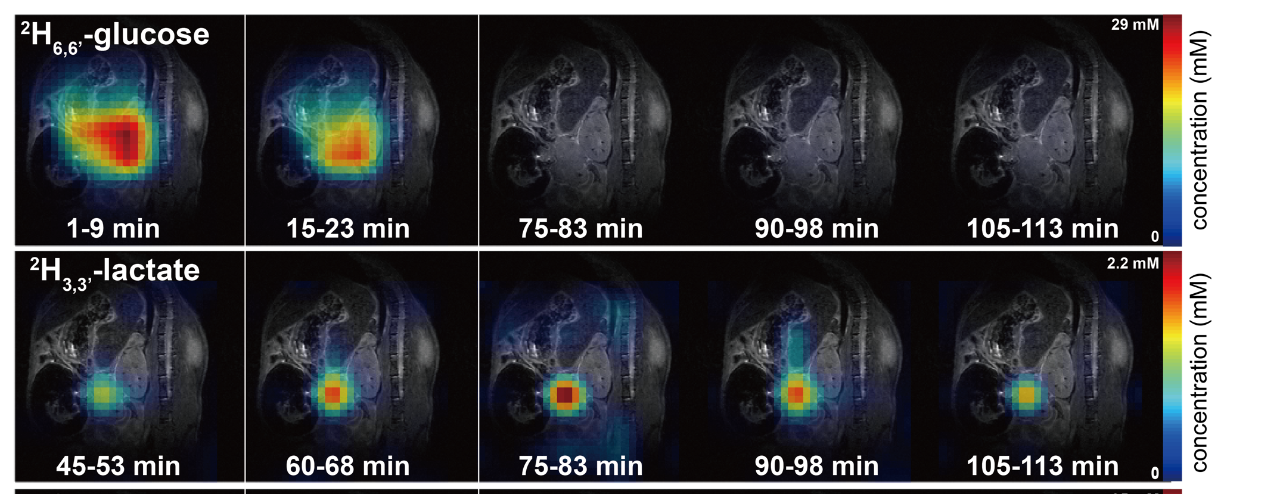 Metabolism in Disease | Bruker