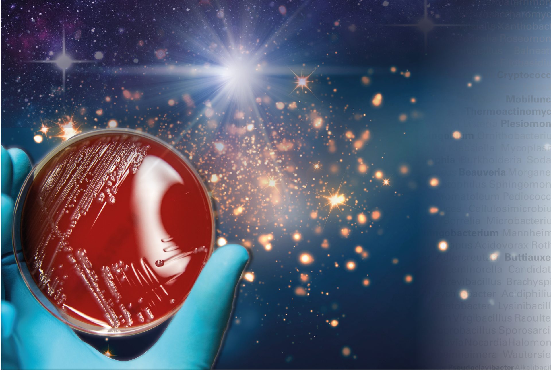 MALDI Biotyper® for Microbial Research | Bruker