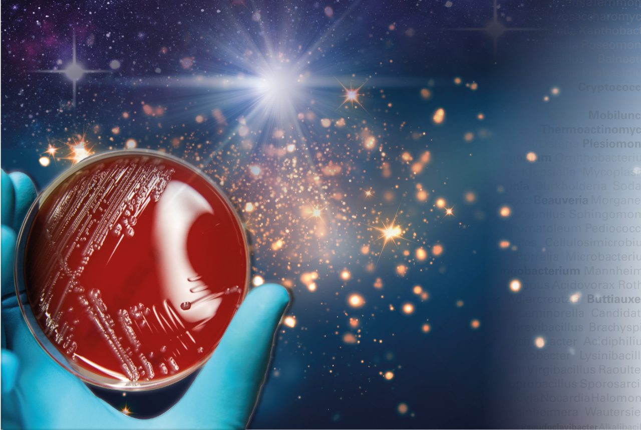 MALDI Biotyper® for Microbial Research | Bruker