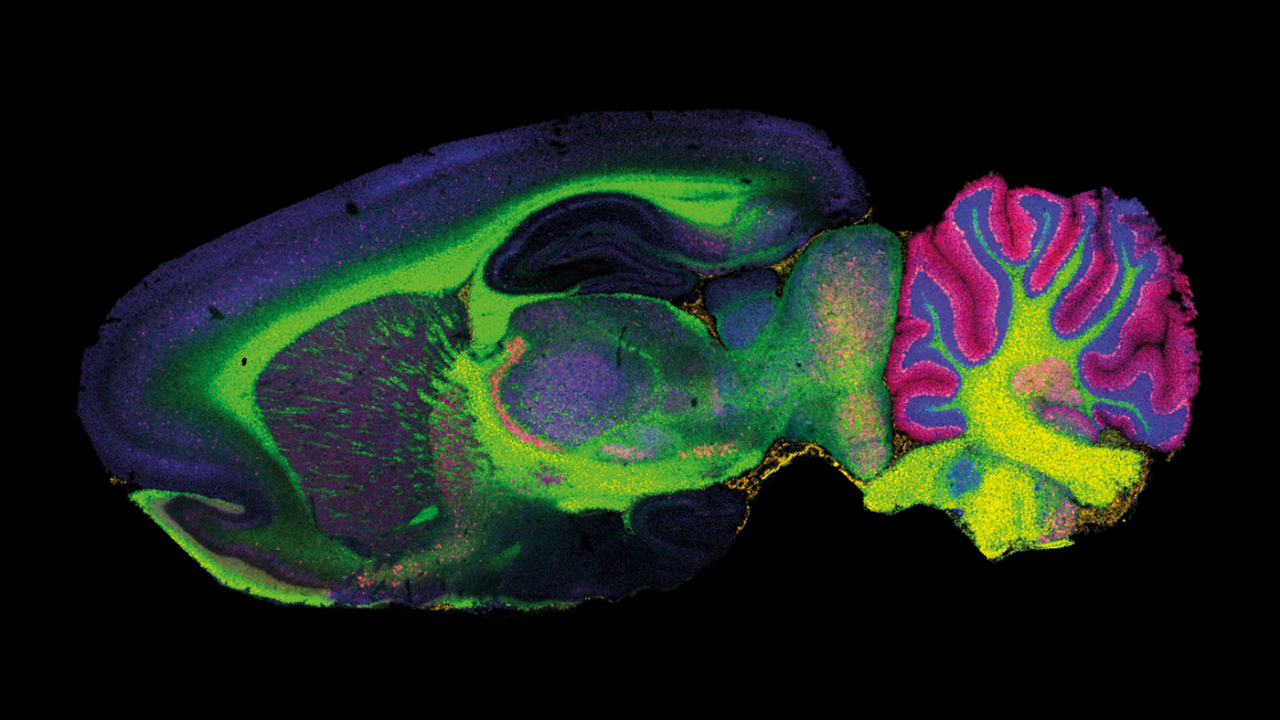 Related material for SCiLS autopilot | Bruker