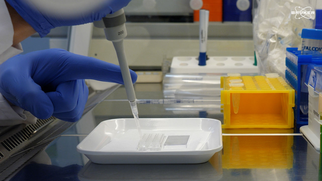 Nanoparticle Analyzer | Bruker