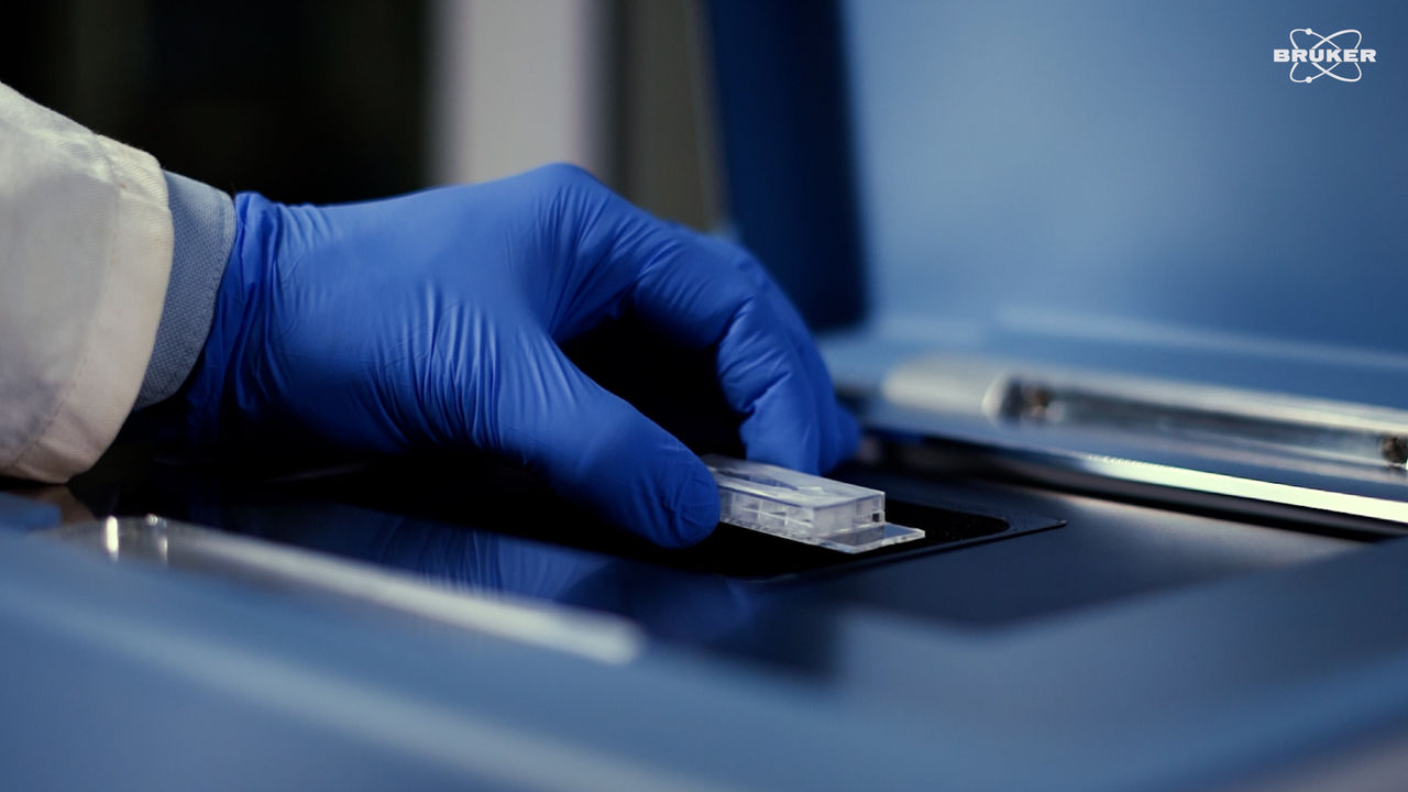 Nanoparticle Analyzer | Bruker