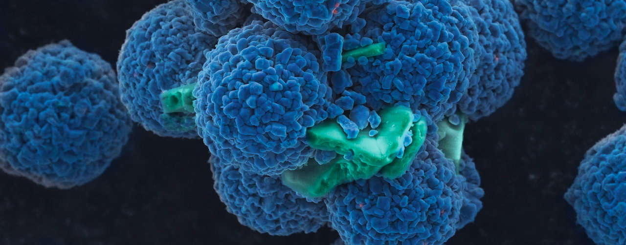 Workshop: Transform Challenging EDS Measurements into Routine ...