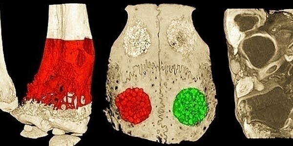 A Universal microCT Analysis Pipeline for Bone Preclinical Disease ...