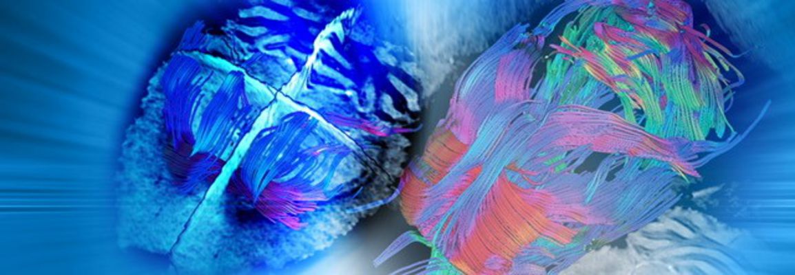 DTI Connectomics in Mouse Models of Neurological Disorders | Bruker