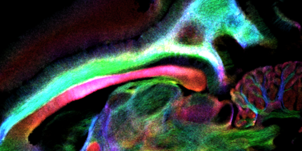 Use of Ultra-high Field MRI for In and Ex Vivo Neuroimaging | Bruker