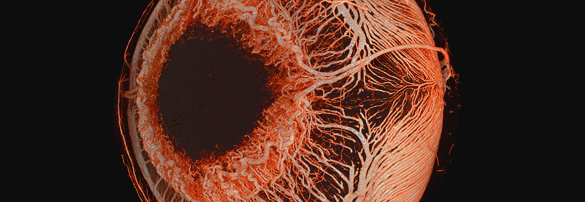 Ex Vivo MicroangioCT: Advances in Microvascular Imaging | Bruker