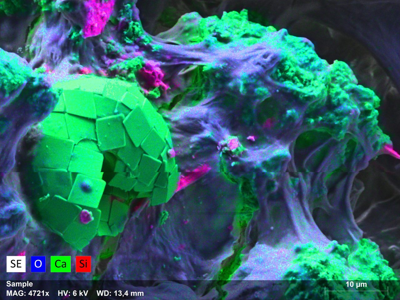 Fast, Accurate and Precise Quantification Results Using an Annular Silicon Drift Detector ...