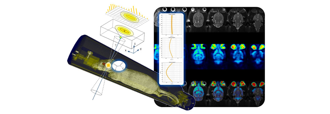 PET Image Reconstruction Overview - Current and Future Trends | Bruker