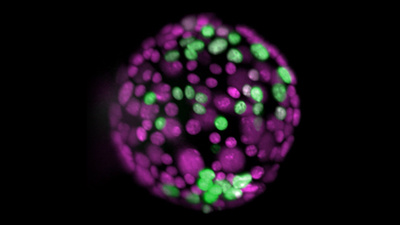 Imaging Breast Cancer Evolution in 3D Organoid Cultures | Bruker