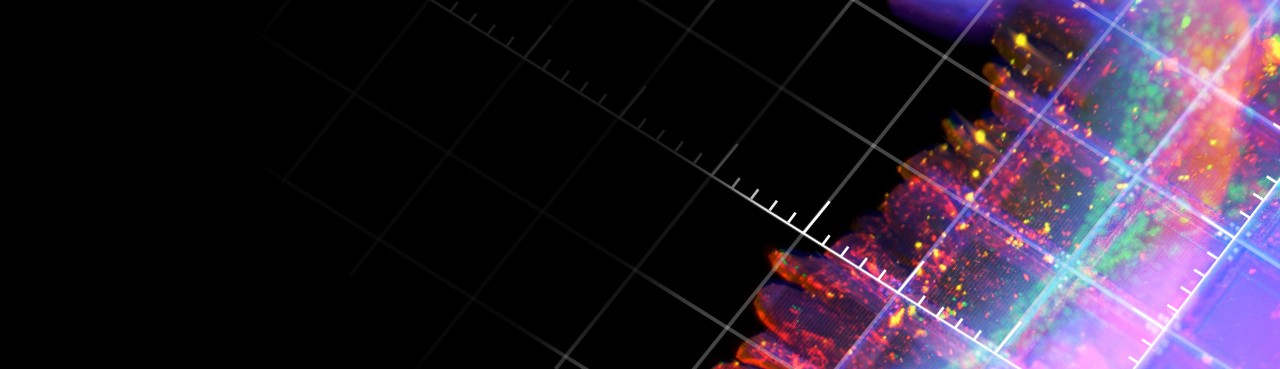 Effective Processing of Light-Sheet Microscopy Images with the Luxendo Image Processor | Bruker