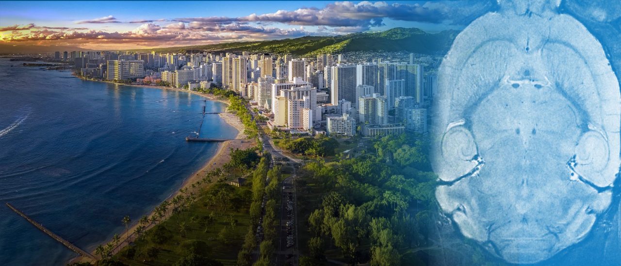 Multinuclear Magnetic Resonance Spectroscopy and Molecular Imaging | Bruker