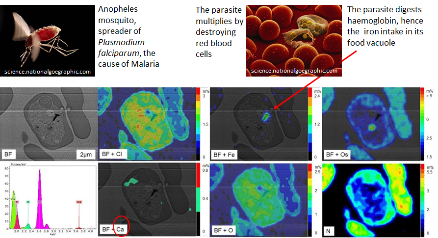 Chemistry of a malaria parasite in human blood and immunolabels in a ...