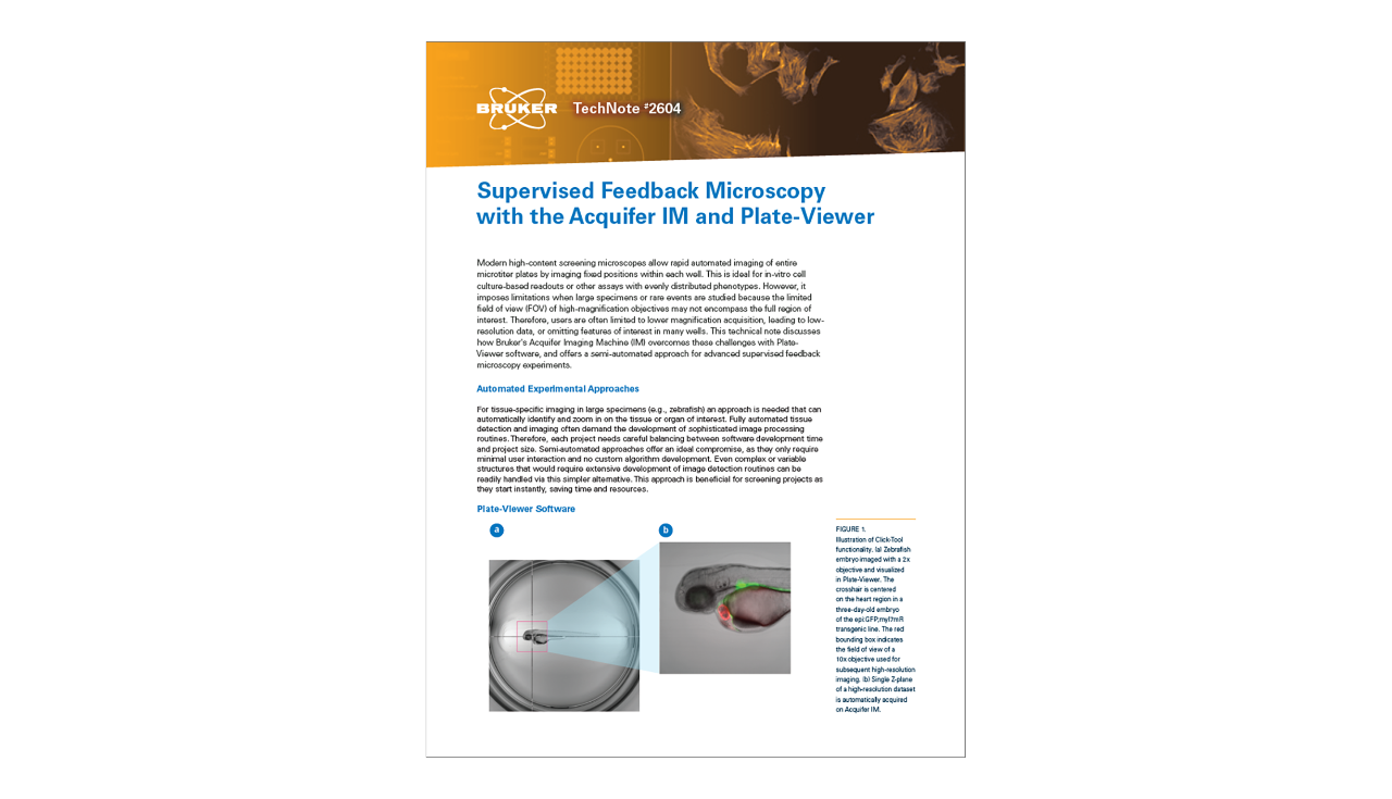 Tech Note: Supervised Feedback Microscopy with the Acquifer IM and the ...