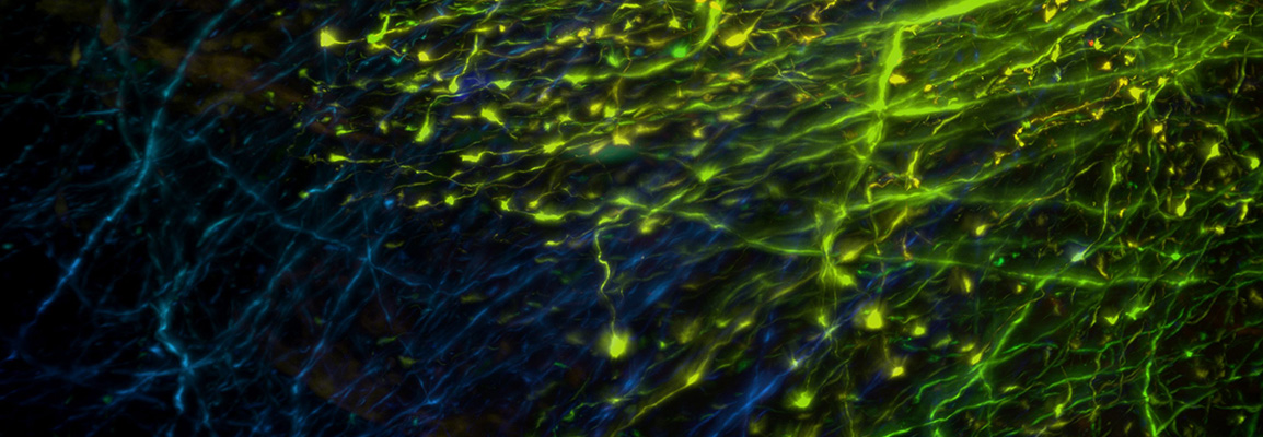 Cleared Sample Imaging with Light-Sheet Microscopy | Bruker