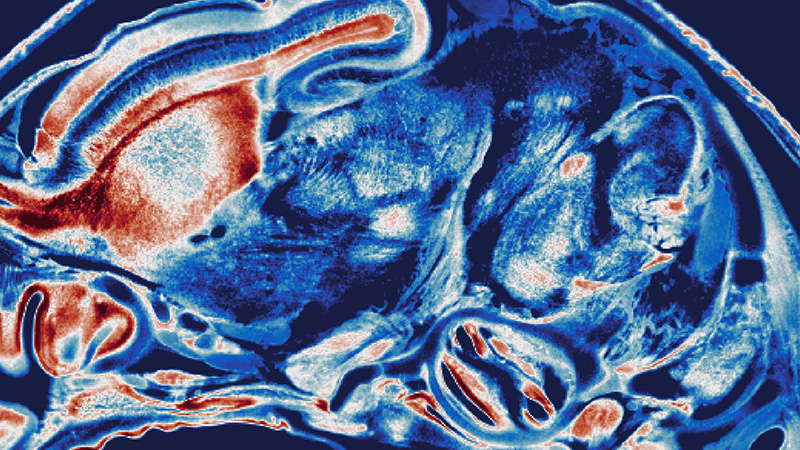 Cleared Sample Imaging with Light-Sheet Microscopy | Bruker