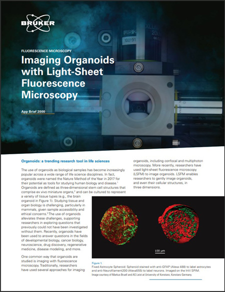 AB2000 Imaging Organoids with Light-Sheet Fluorescence Microscopy | Bruker