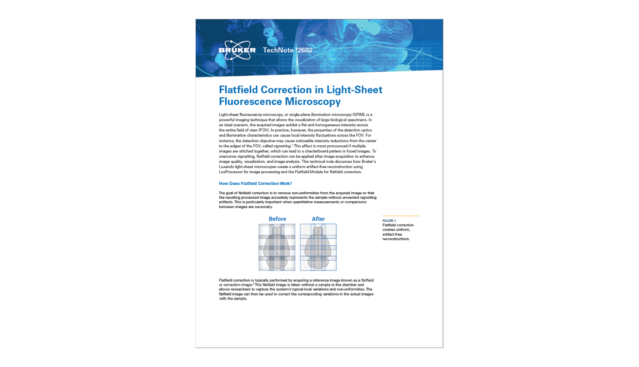 Flatfield Correction In Light Sheet Fluorescence Microscopy Bruker