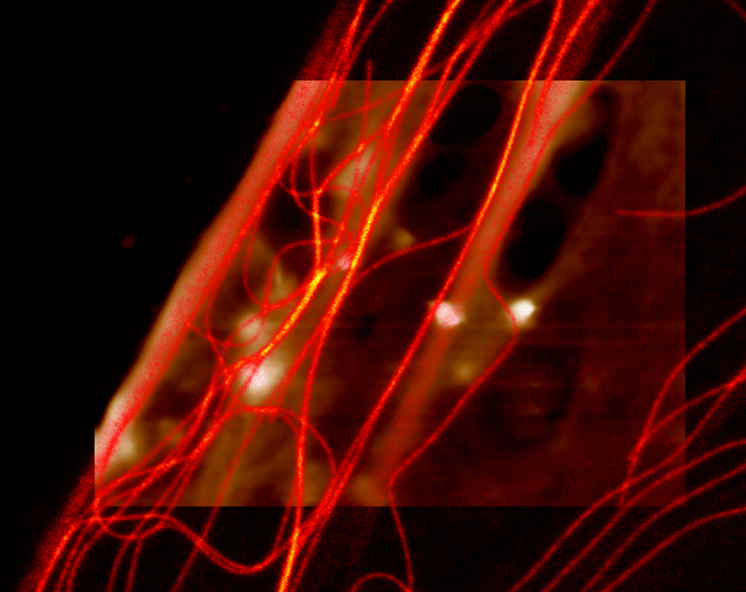 Correlative AFM and STED Microscopy | Bruker