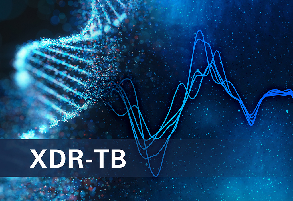 LiquidArray® MTB-XDR VER 1.0 | Bruker