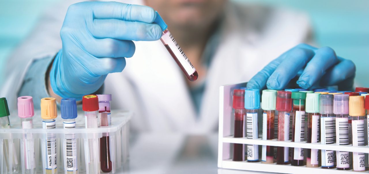 BioBank Standardization | QC Process | Bruker