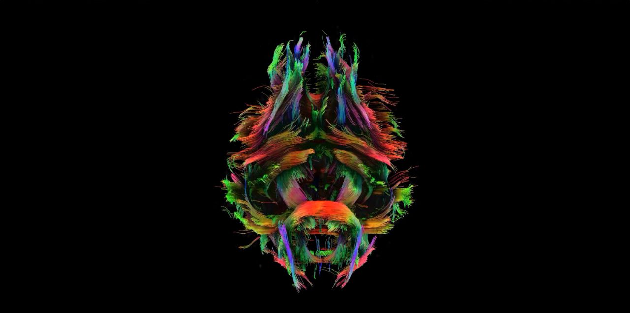 Small Animal Imaging | Large MRI | Bruker