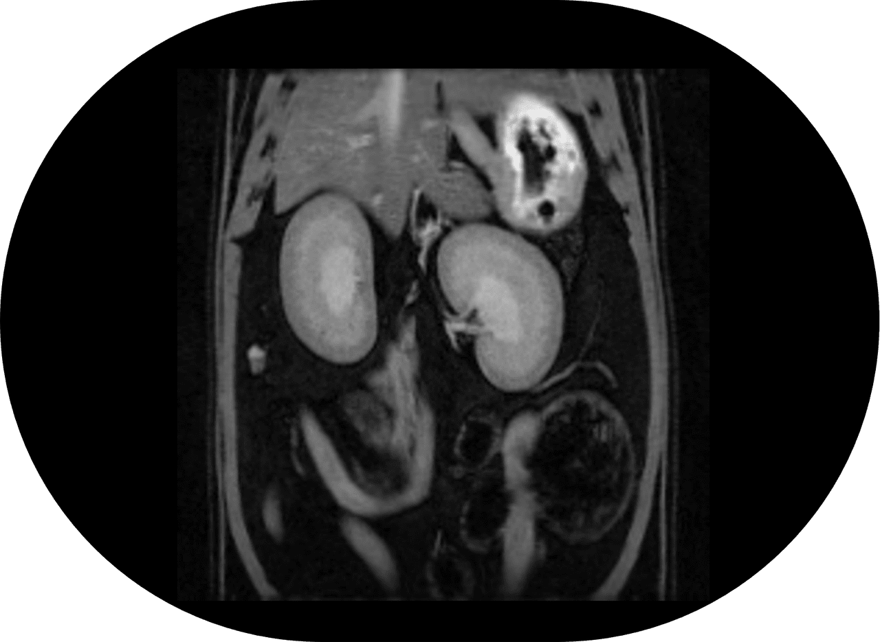 MRI RF Coils | RF Coil Technical Details | Bruker
