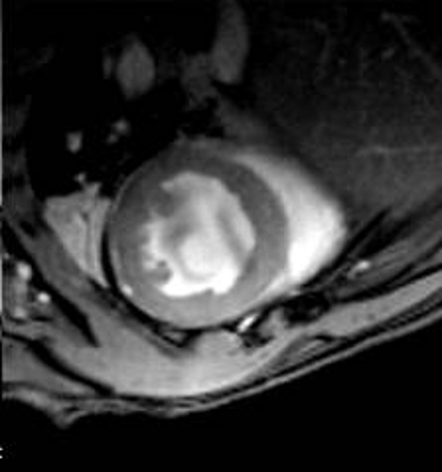 MRI RF Coils | RF Coil Technical Details | Bruker