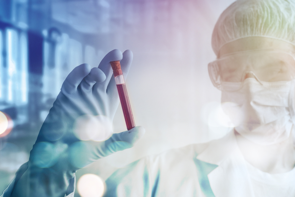 1H-NMR for the Evaluation of Biofluids Sample Quality in Metabolomic ...