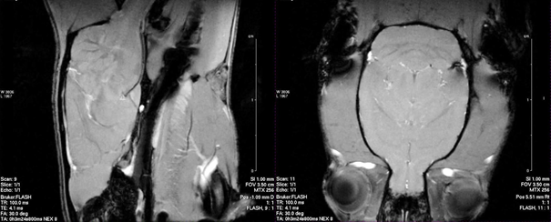 In-Vivo Rat Brain Imaging in vertical bore magnet MR-Microscopy | Bruker