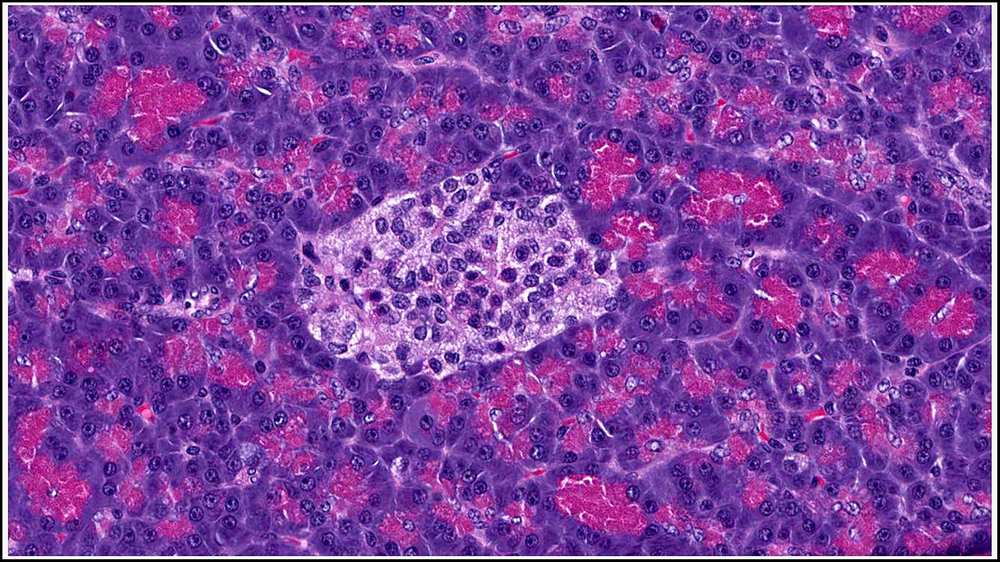 Novel Methodology for Labelling Pancreatic Islets Prior to ...