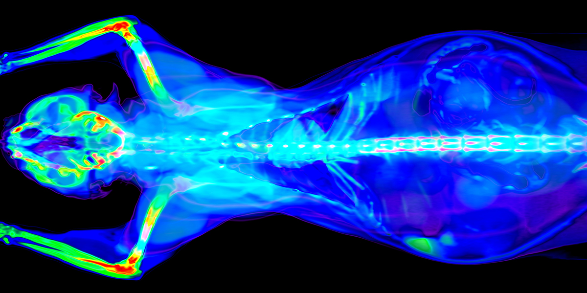 Lead Optimization | Bruker