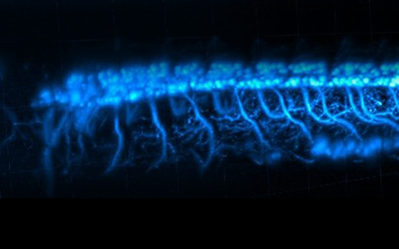 Bruker Fluorescence Microscopy Solutions for Zebrafish Imaging | Bruker