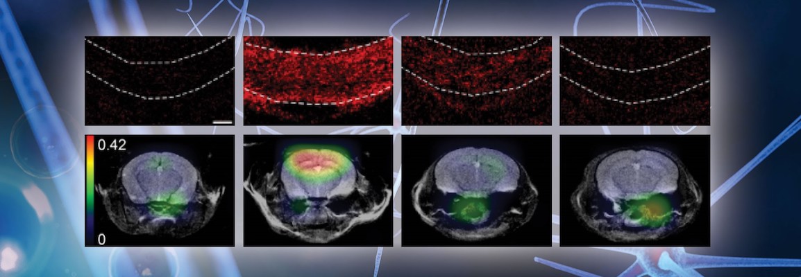 Preclinical Hyperpolarized Carbon-13 Magnetic Resonance Imaging in ...