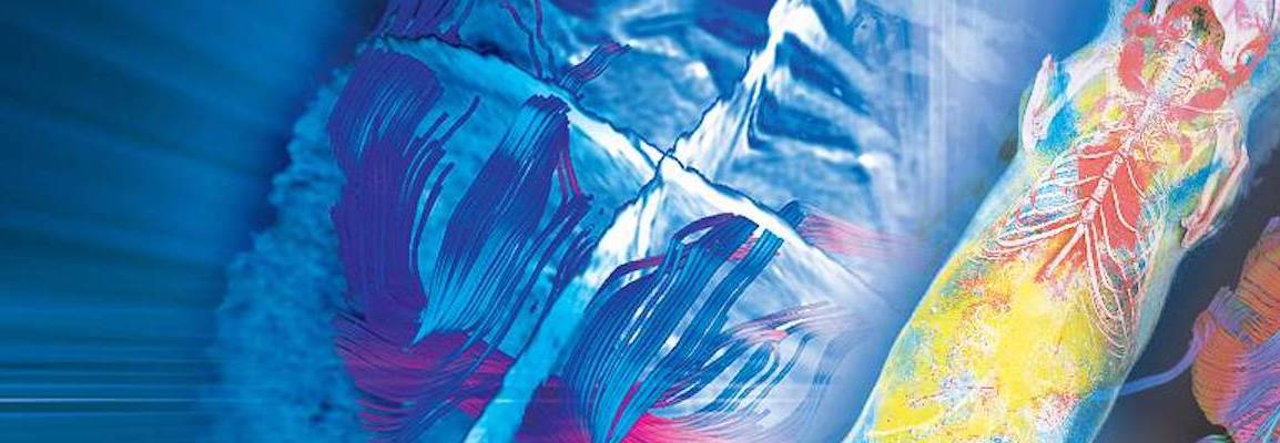 Rapid, Quantitative CEST Imaging with MRI Fingerprinting | Bruker