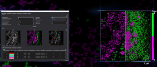 Single-Molecule Localization Microscopy: Beyond the Coverslip | Bruker