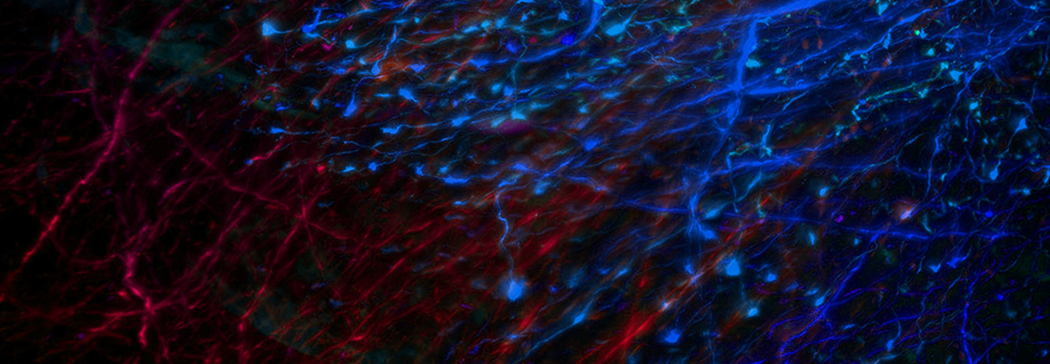 Cellular Mapping of an Entire Organism Using Whole-Body Tissue Clearing ...