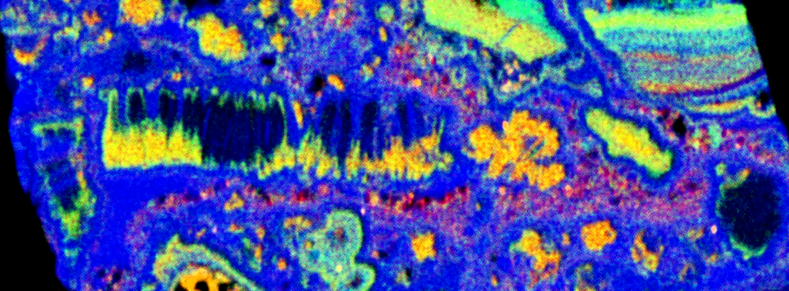 Introducing XTrace 2 the Next-Generation for Enhanced Micro-XRF on SEM | Bruker