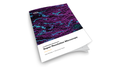 [E-Book] Super-Resolution Microscopy | Bruker