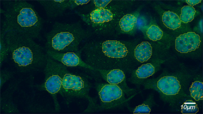RNA Visualization and Quantification with Single Molecule FISH (smFISH ...