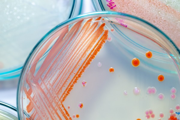 MALDI Biotyper® sirius one System | Bruker