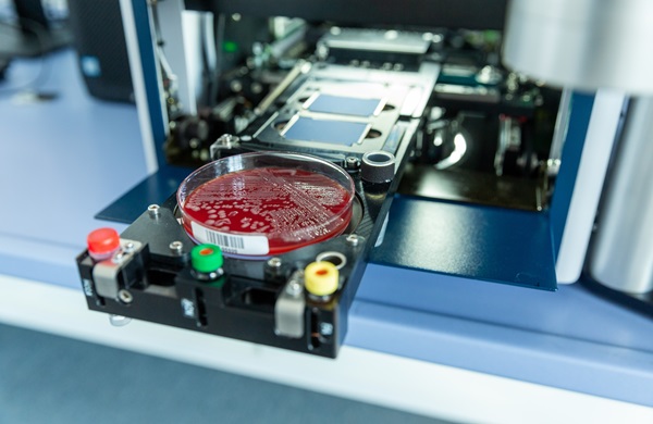 Automated sample preparation by MBT Pathfinder® & Feeder | Bruker