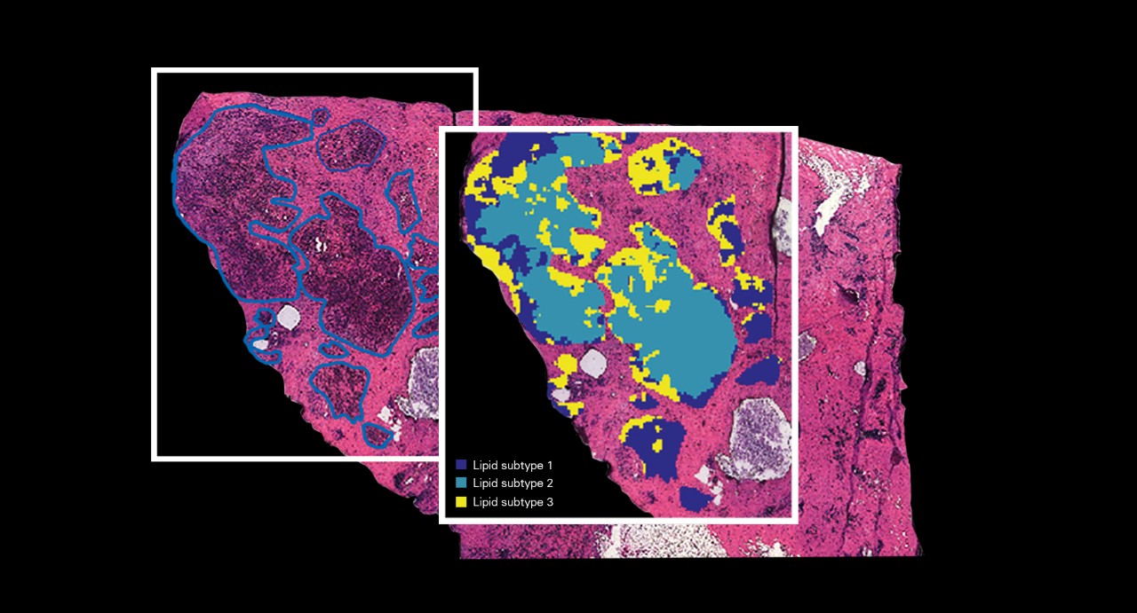 MALDI Guided SpatialOMx | Bruker