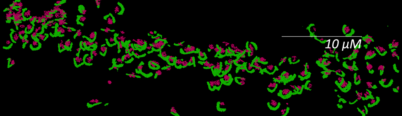 Super-Resolution Microscopes | Bruker