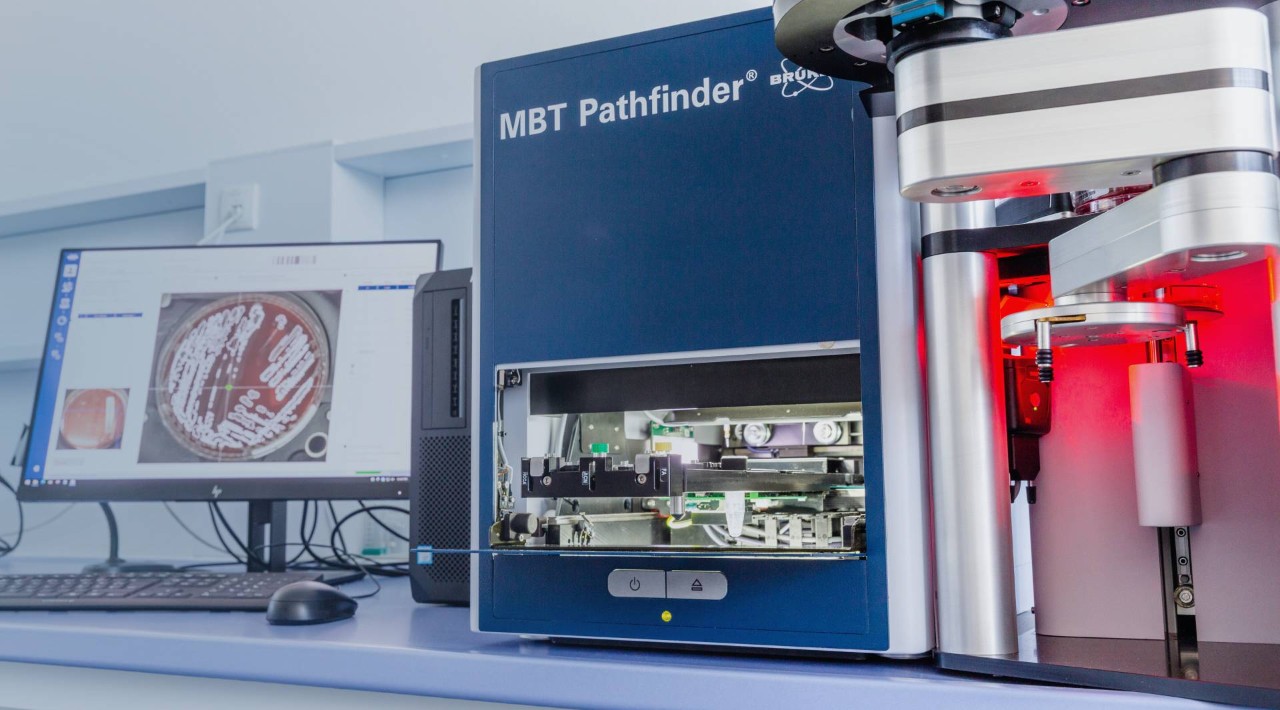 Automated sample preparation by MBT Pathfinder® & Feeder | Bruker
